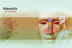 Understanding Diseases - Focus Medica